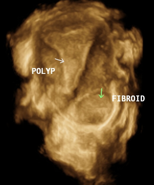 Pregnancy sonography | Anomalies scan | NT scan | fetal ...